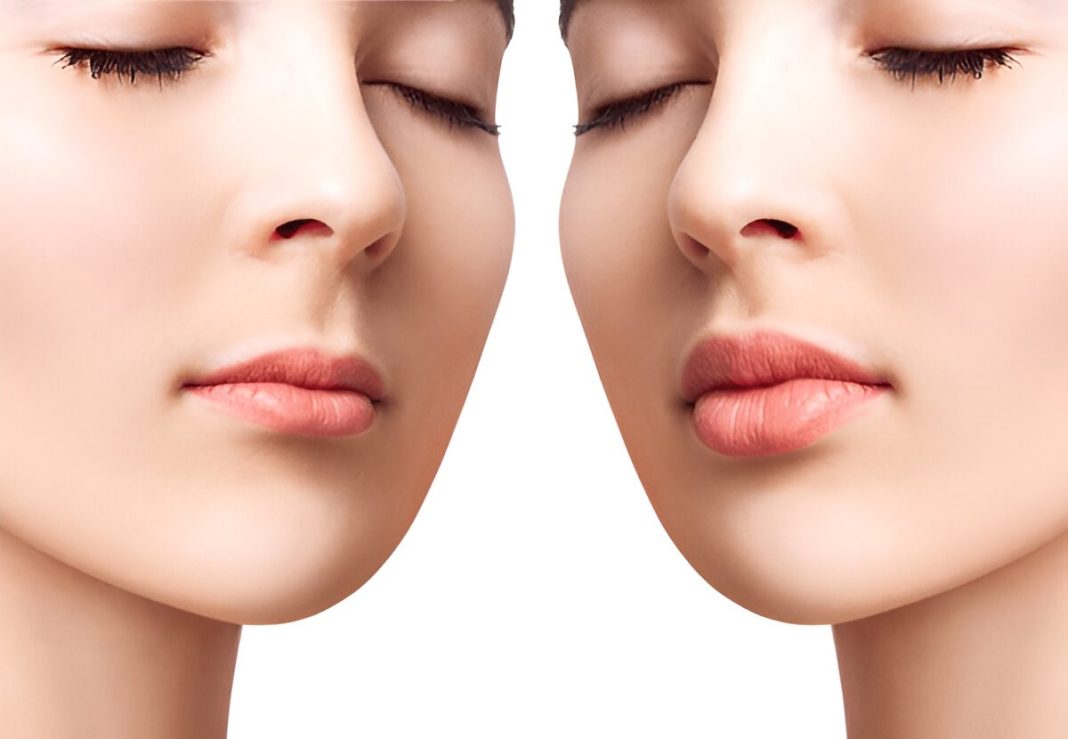 Lip Flip vs Lip Filler Dubai – Which One’s Right for You? - Pressversity